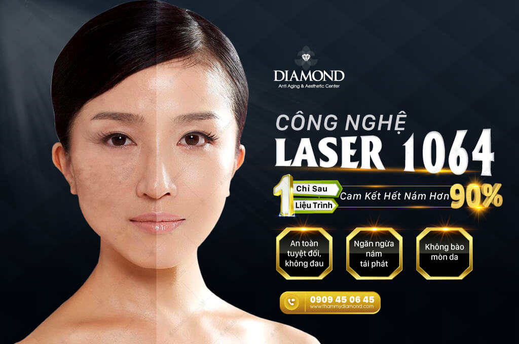Công nghệ laser 1064 là gì? Liệu pháp trị tận gốc nám