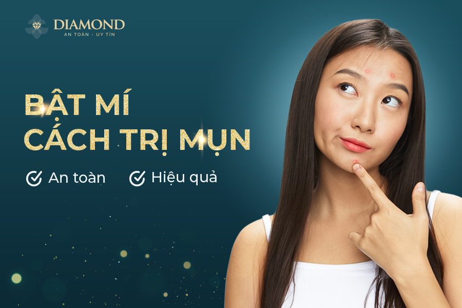Bật mí 5 phương pháp trị mụn cấp tốc, an toàn, hiệu quả